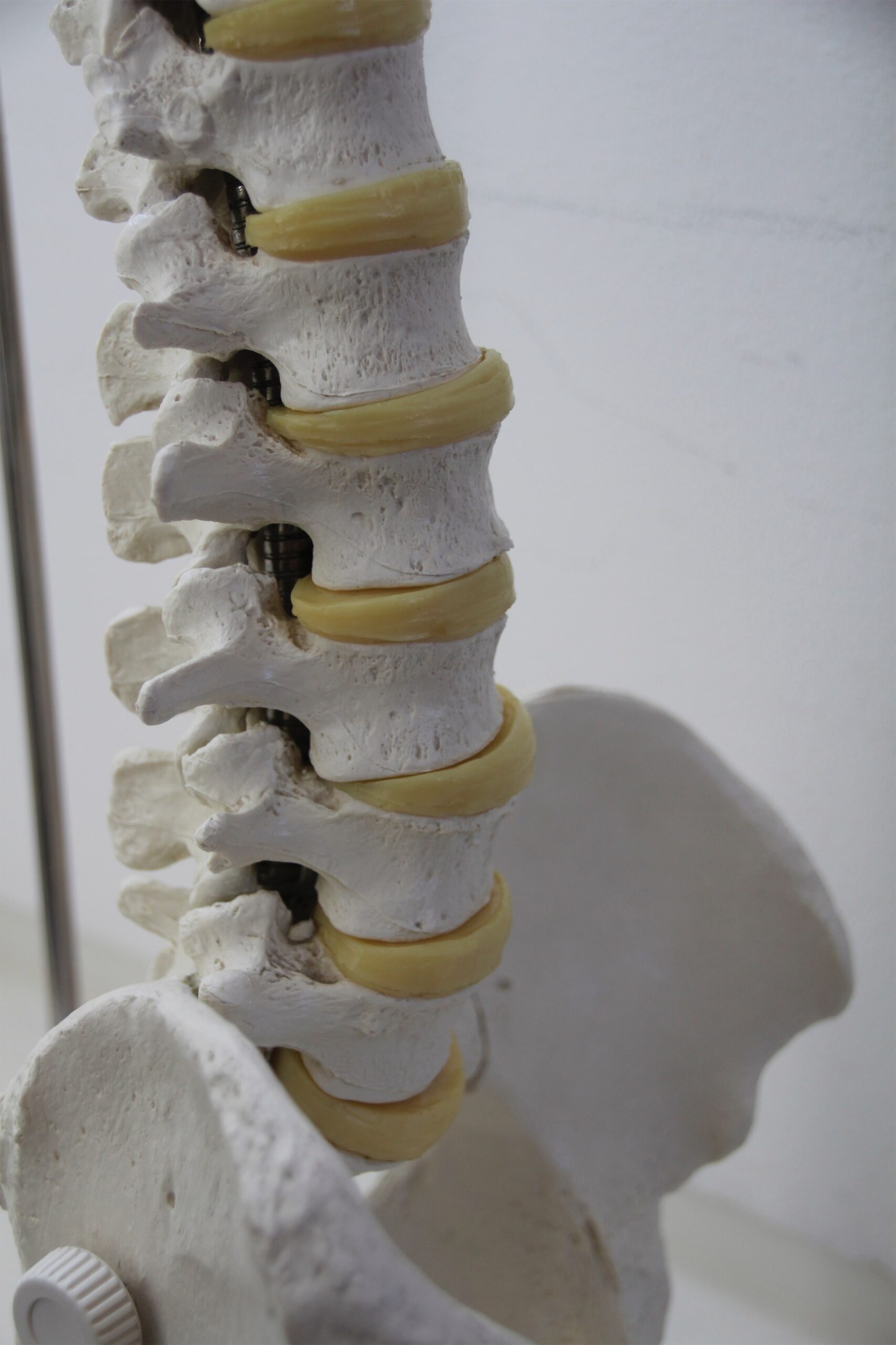 Dynamic Hip Screw (behandelingsvorm bij heupfractuur) - Praktijk Prins ...